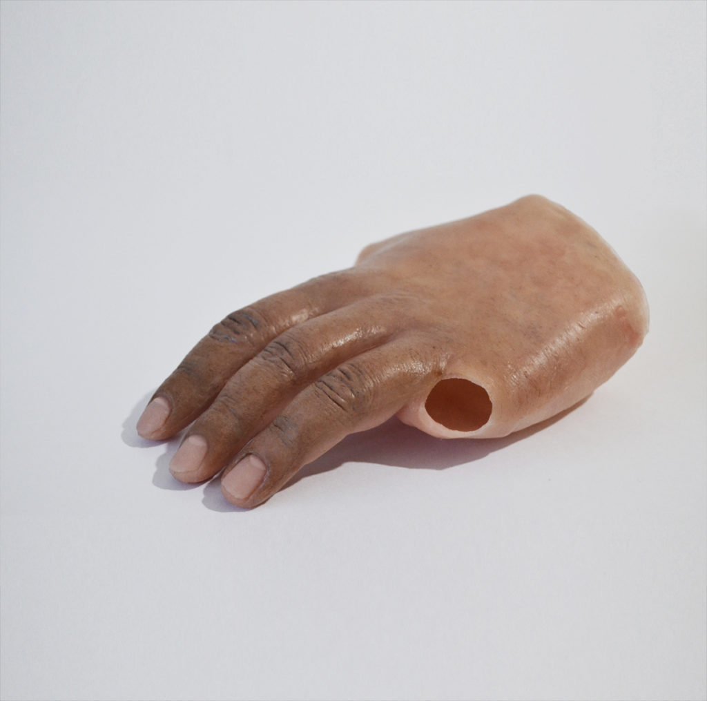 Prótesis de Mano – Silskin